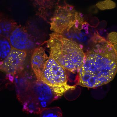 Sphere Structures in the Cell [IMAGE] | EurekAlert! Science News Releases