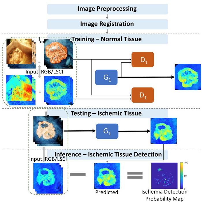 Intestinal-ischemia-figure [IMAGE] | EurekAlert! Science News Releases