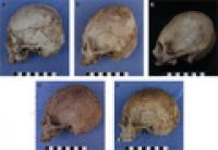The role of cranial modification in identity | EurekAlert!