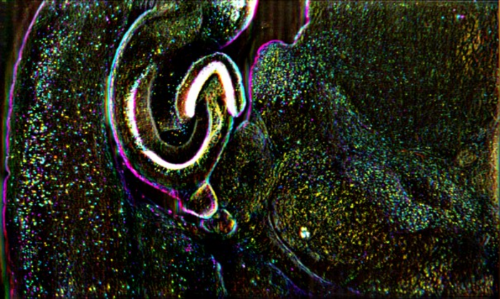 Mouse Brain Slice [IMAGE] | EurekAlert! Science News Releases