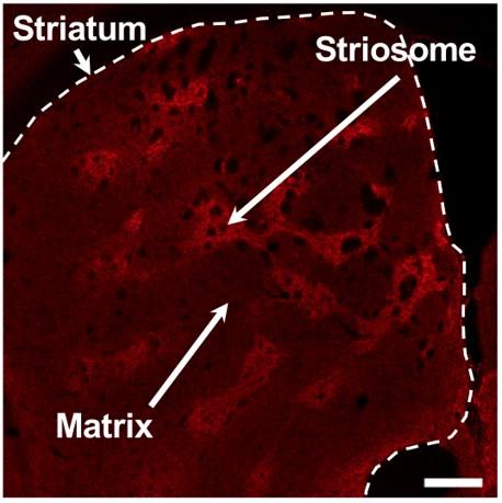 'Striosome' neurons in the basal ganglia play | EurekAlert!