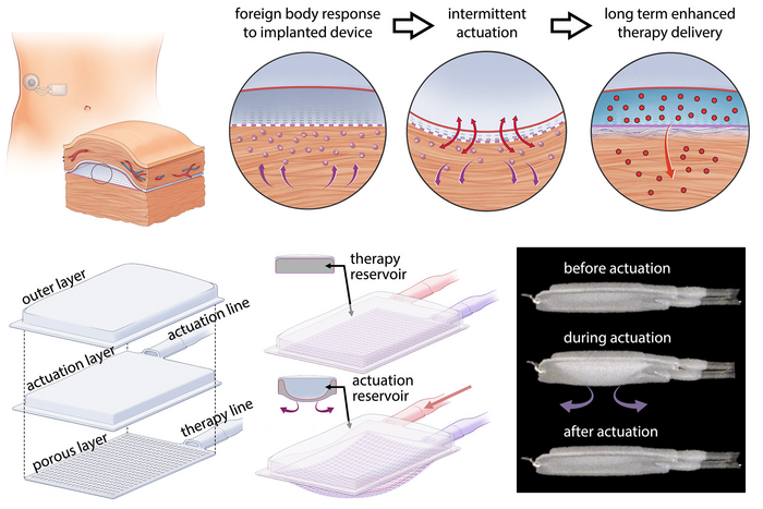 Drug-delivery system [IMAGE] | EurekAlert! Science News Releases