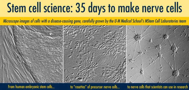 Stem cell success: Couple shields son from fa | EurekAlert!