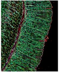 Border patrol: Immune cells protect body from | EurekAlert!
