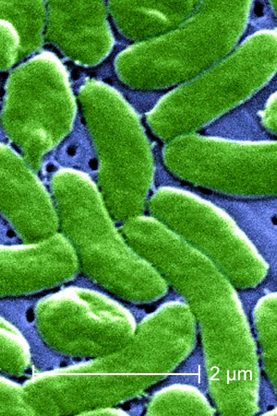 Vibrio vulnificus Bacte [IMAGE] | EurekAlert! Science News Releases
