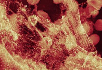 White Blood Cells and NETs [IMAGE] | EurekAlert! Science News Releases