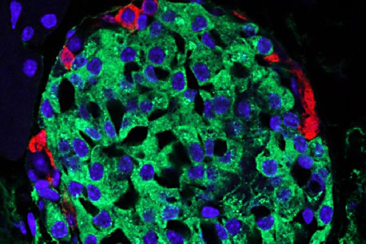 Islet Cell [IMAGE] | EurekAlert! Science News Releases