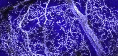 Silver-Labeled Dendrites [IMAGE] | EurekAlert! Science News Releases