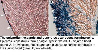 Scarring a necessary evil to prevent further | EurekAlert!