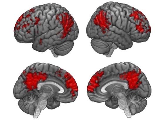 Multilingual Brain Scans [IMAGE] | EurekAlert! Science News Releases