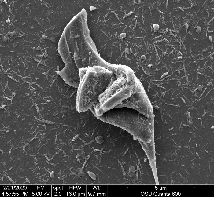 Electron microscope image of m [IMAGE] | EurekAlert! Science News Releases