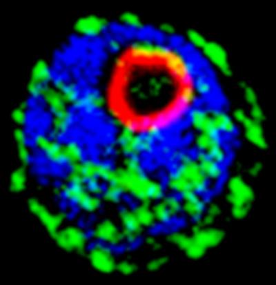 The Sting of WASp in Immune Di [IMAGE] | EurekAlert! Science News Releases