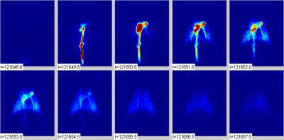A closer look inside our lungs -- Penn resear | EurekAlert!