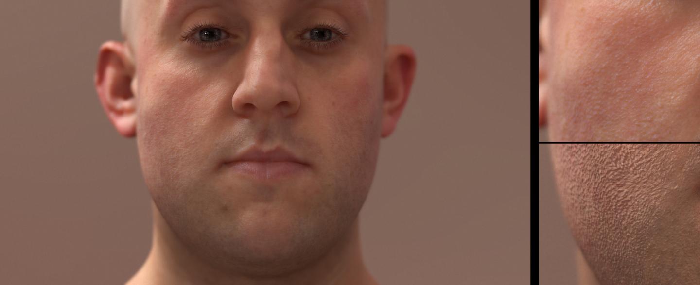 Skin [IMAGE] | EurekAlert! Science News Releases