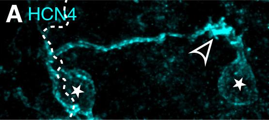 Bipolar Cell Dendrites [IMAGE] | EurekAlert! Science News Releases