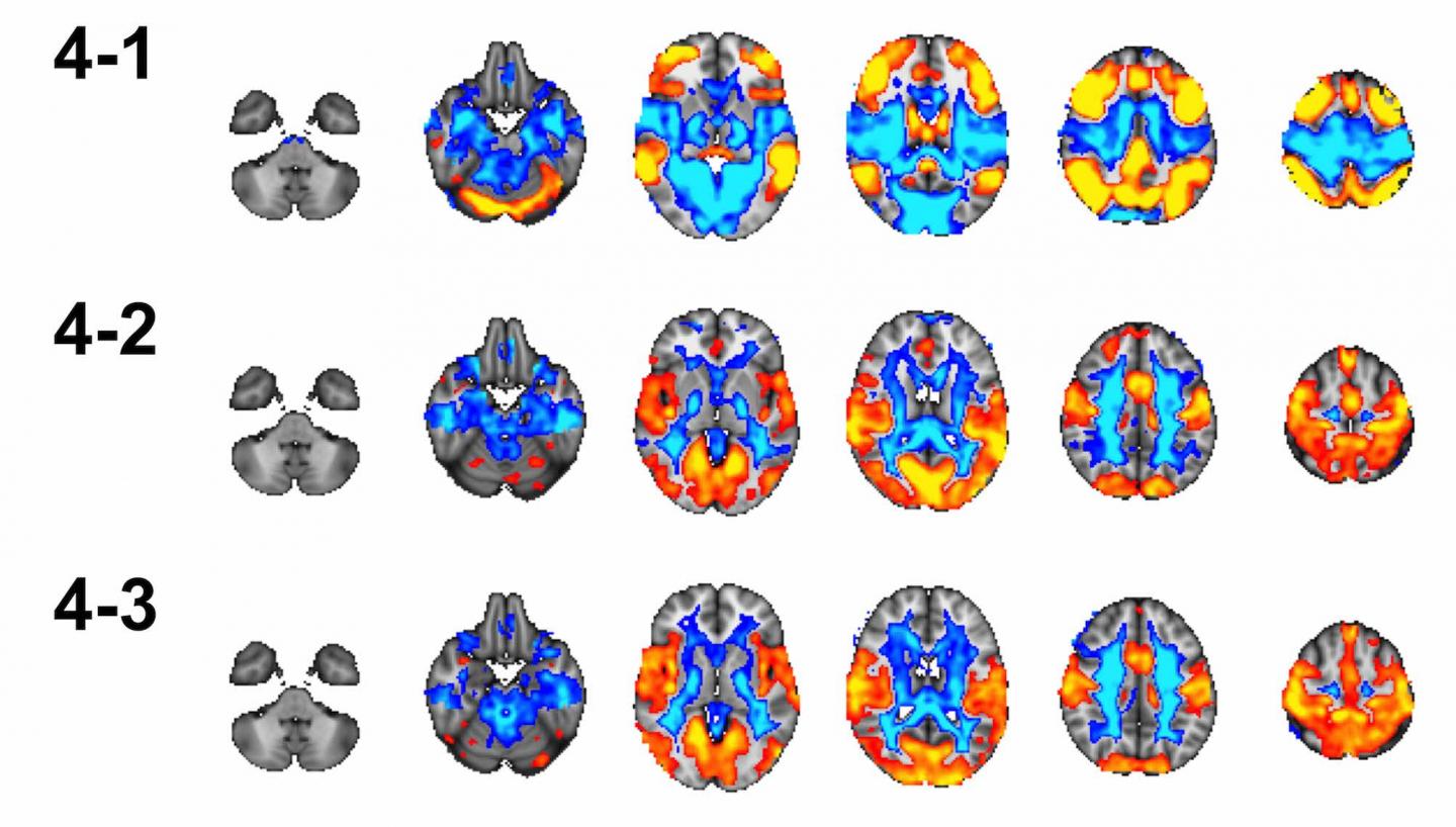 Efficient Teen Brain [IMAGE] | EurekAlert! Science News Releases