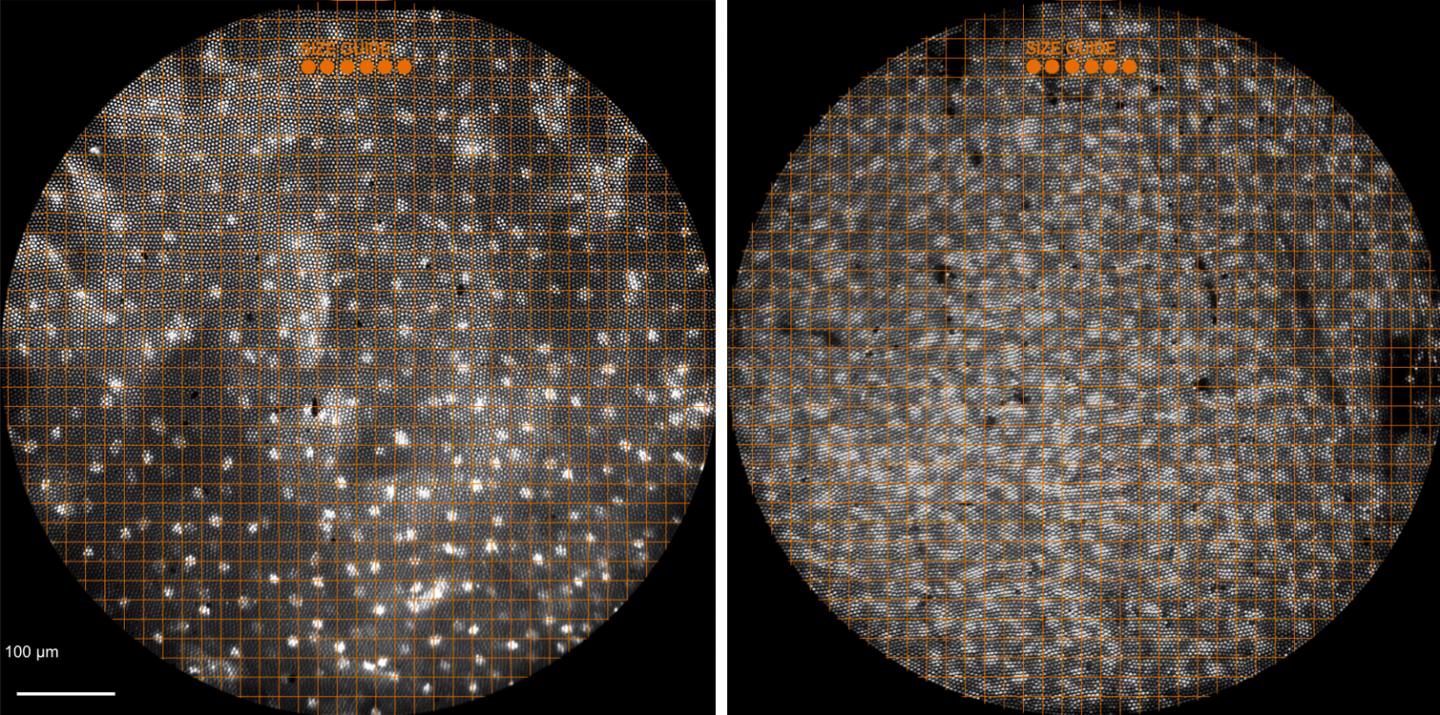 High-Resolution Microendoscope [IMAGE] | EurekAlert! Science News Releases