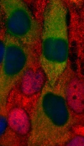 STAT2: Much More Than an Antiv [IMAGE] | EurekAlert! Science News Releases