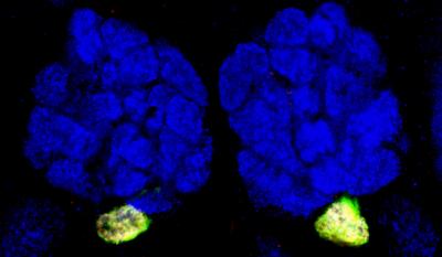 Nerve Gas [IMAGE] | EurekAlert! Science News Releases
