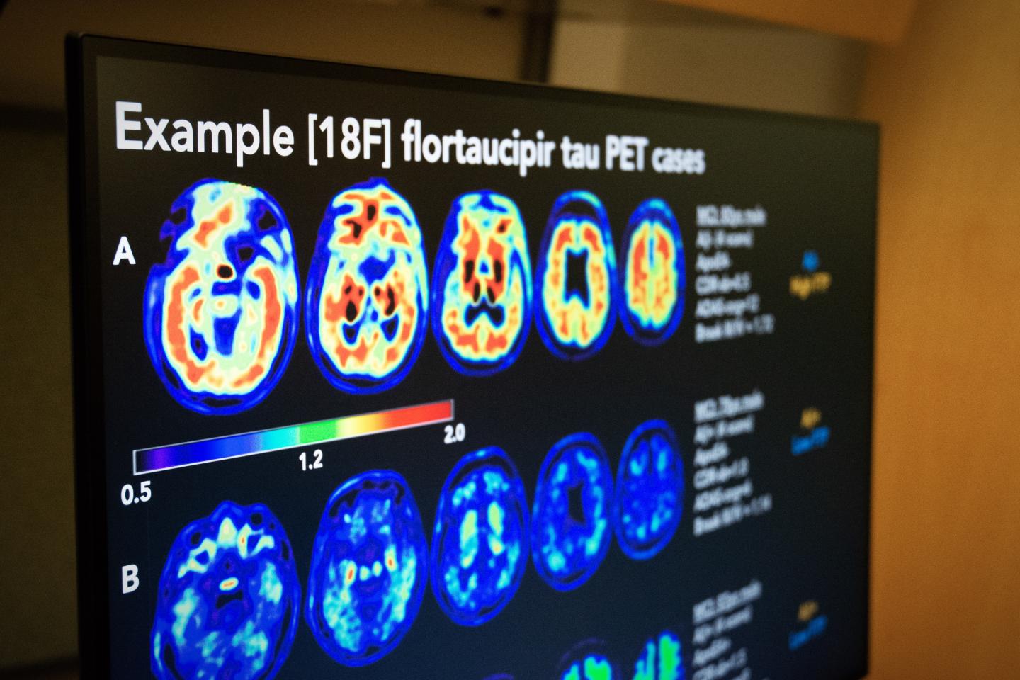 $47 million grant adds brain imaging to large | EurekAlert!