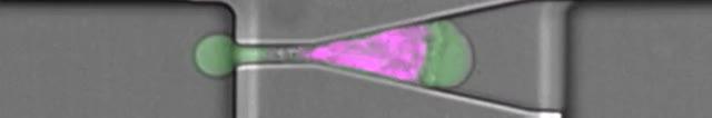 The Nucleus Acts as a Ruler Tailoring Cell Re | EurekAlert!