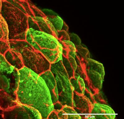 Healing powers | EurekAlert!