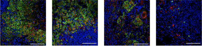 IDO Activity [IMAGE] | EurekAlert! Science News Releases