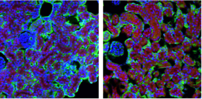 Kidney Cells [IMAGE] | EurekAlert! Science News Releases