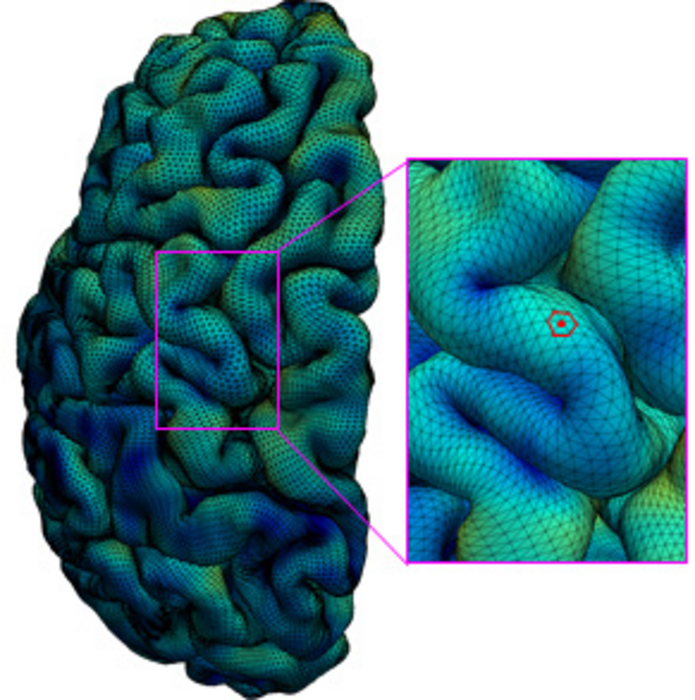 mri mesh [IMAGE] | EurekAlert! Science News Releases