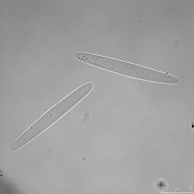 Giant Bacteria Make Algae Easy [IMAGE] | EurekAlert! Science News Releases