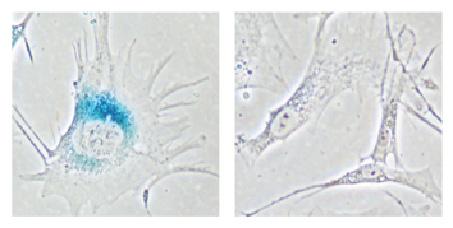Senescent Vs. Non-Senescent Ce [IMAGE] | EurekAlert! Science News Releases