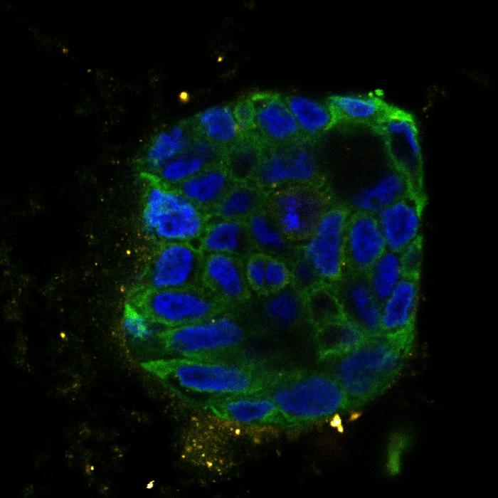 Organoid of a patient with col [IMAGE] | EurekAlert! Science News Releases