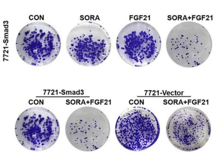 FGF21 combined with SORA promo [IMAGE] | EurekAlert! Science News Releases