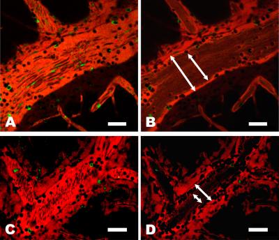 Mouse Postcapillary Venules [IMAGE] | EurekAlert! Science News Releases