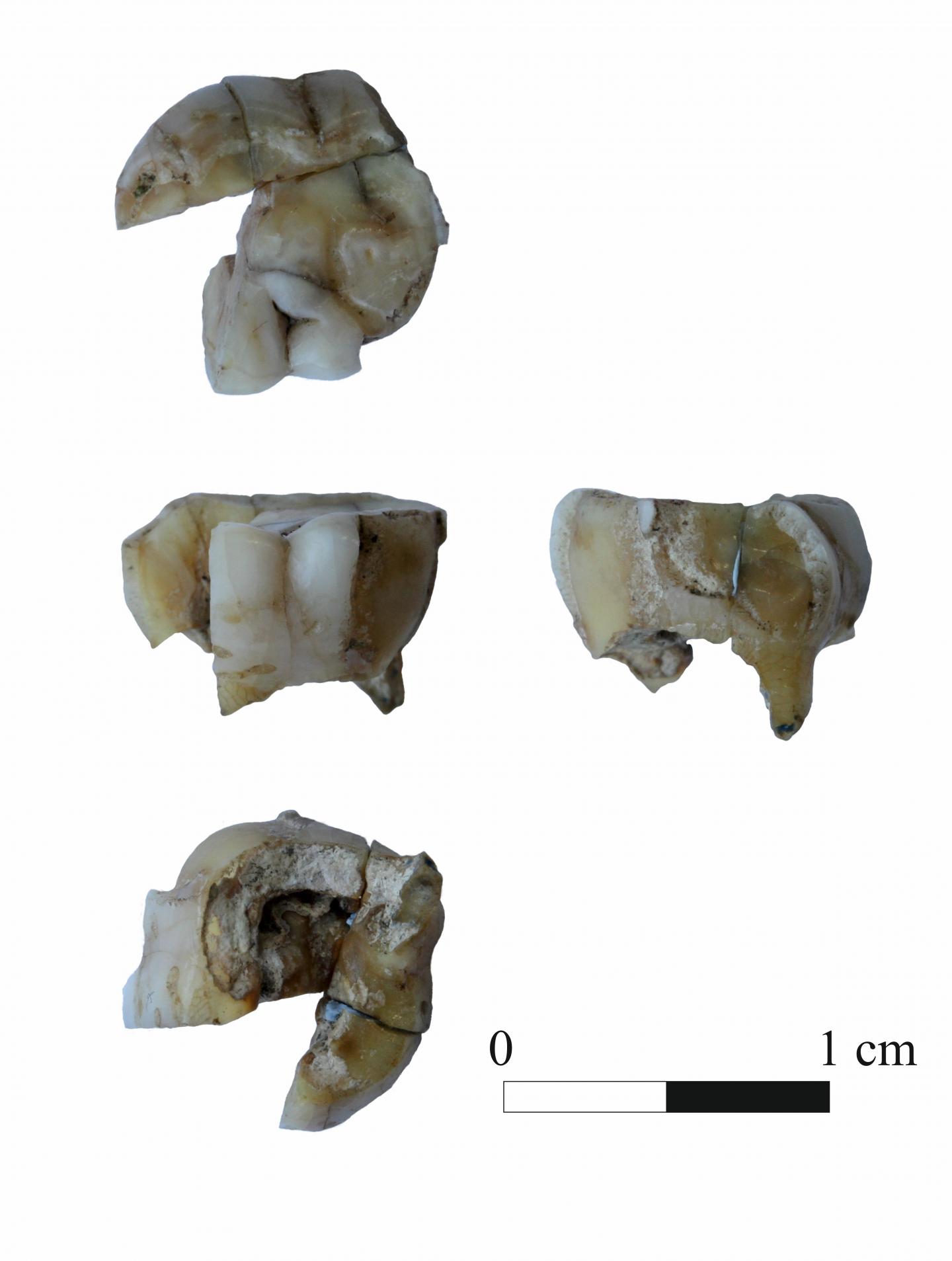 Fragmented Tooth of Individual [IMAGE] | EurekAlert! Science News Releases