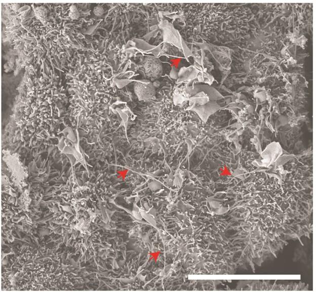 Stem cell-based screen identifies potential n | EurekAlert!