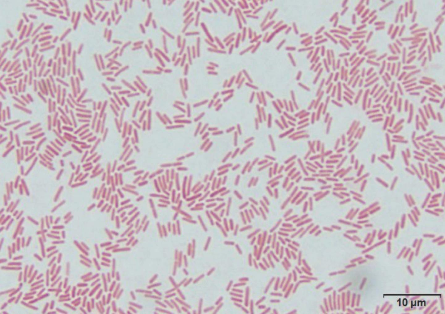 Pan-Microbial Study Implicates [IMAGE] | EurekAlert! Science News Releases