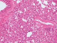 Sensitive balance in the immune system | EurekAlert!