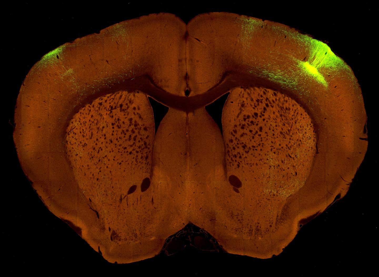 Brain Connectivity [IMAGE] | EurekAlert! Science News Releases