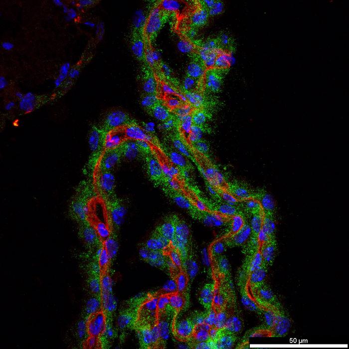 mouse choroid plexus [IMAGE] | EurekAlert! Science News Releases
