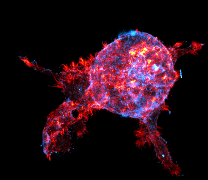 Cancer cell finger-like projec [IMAGE] | EurekAlert! Science News Releases