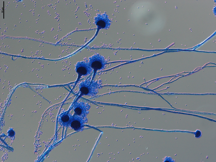 Aspergillus fumigatus [IMAGE] | EurekAlert! Science News Releases