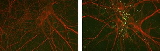 A Collagen XIX Peptide Restore [IMAGE] | EurekAlert! Science News Releases