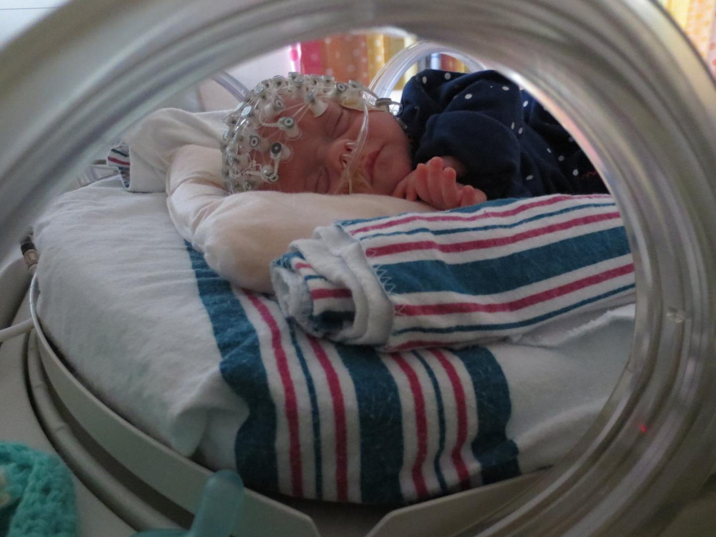 A prescription for touch: Early experiences s | EurekAlert!