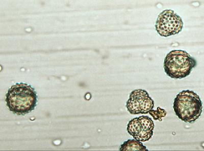 Ragweed Pollen Grains [IMAGE] | EurekAlert! Science News Releases
