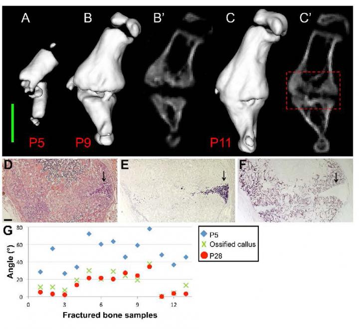 Callus Ossification Progresses [IMAGE] | EurekAlert! Science News Releases