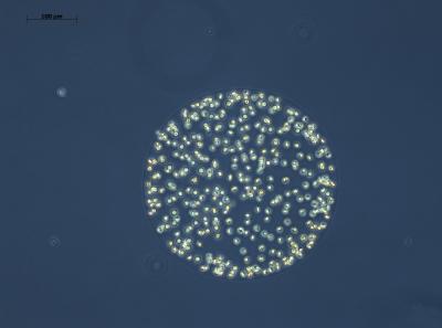 Phaeocystis Colony [IMAGE] | EurekAlert! Science News Releases