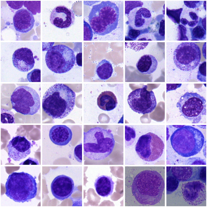 Bone marrow cells [IMAGE] | EurekAlert! Science News Releases
