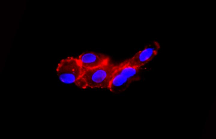 Cell Clusters in the Blood Not Malignant Afte | EurekAlert!