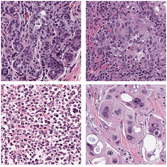 Cell image patches. [IMAGE] | EurekAlert! Science News Releases